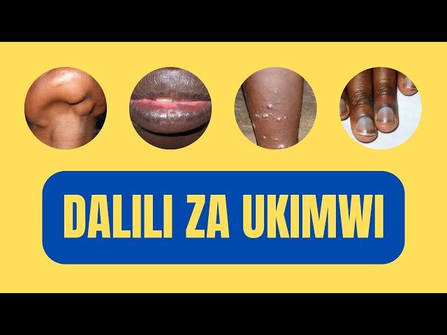 Dalili za Ugonjwa wa Ukimwi kwa Mwanaume, Sababu na Tiba - zoteforum.com