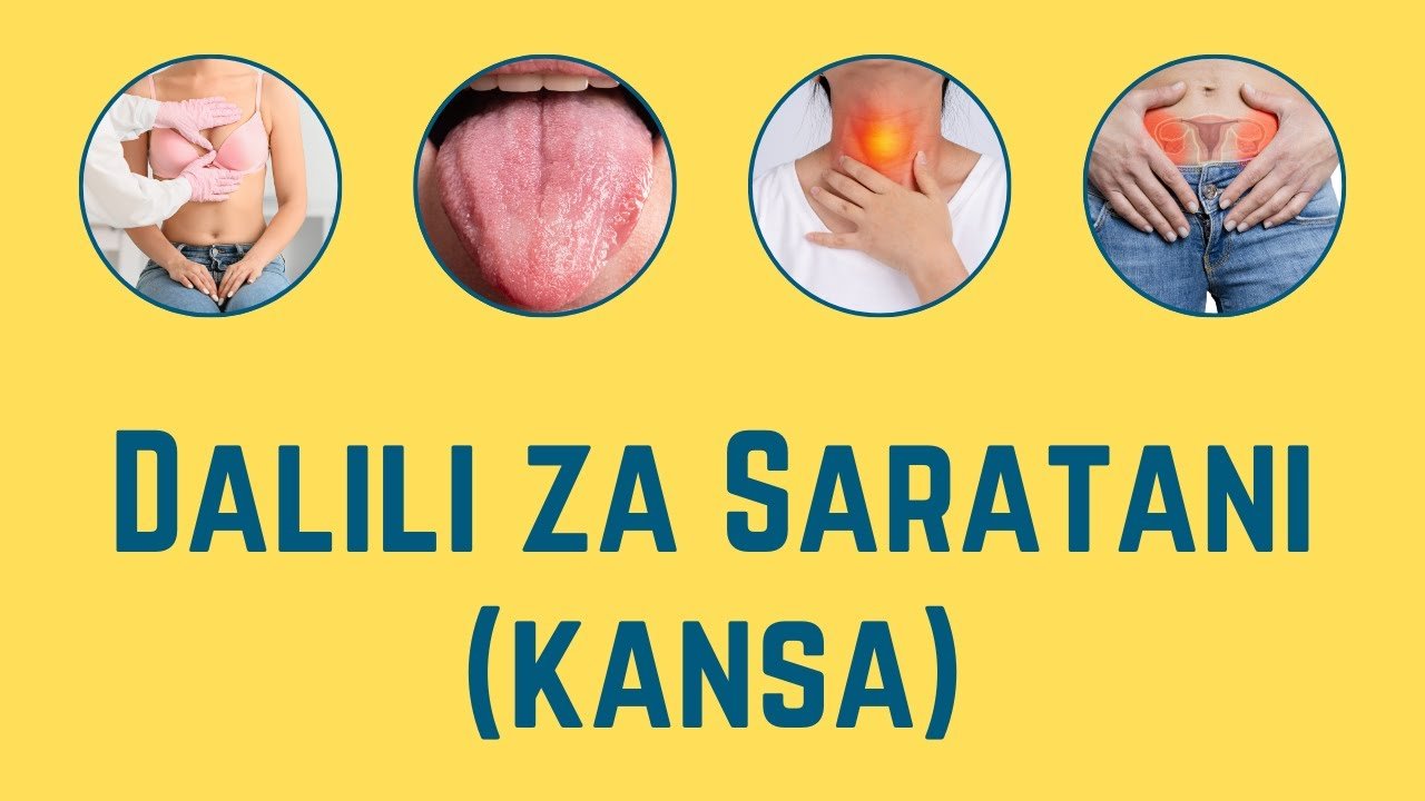 Zijue Dalili za Saratani (kansa), Sababu na Tiba - Zoteforum